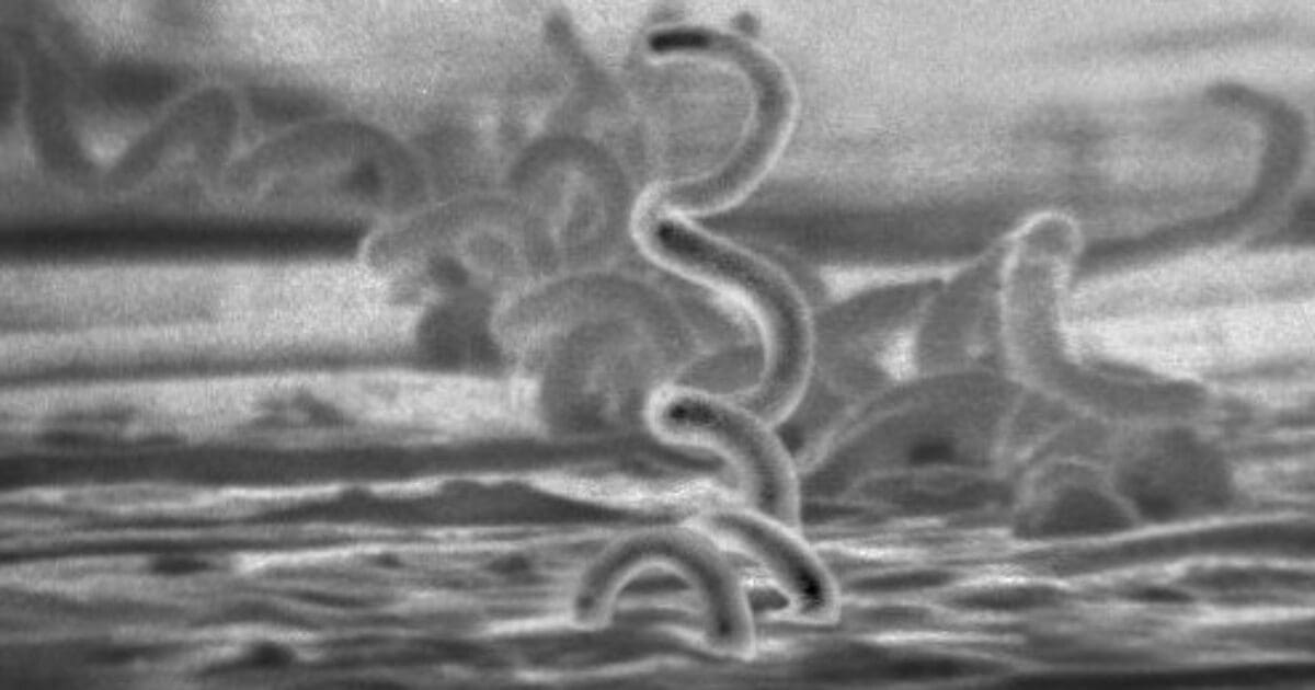 Houston’s Syphilis Rates Skyrocket, Officials Say - Liberty Unyielding
